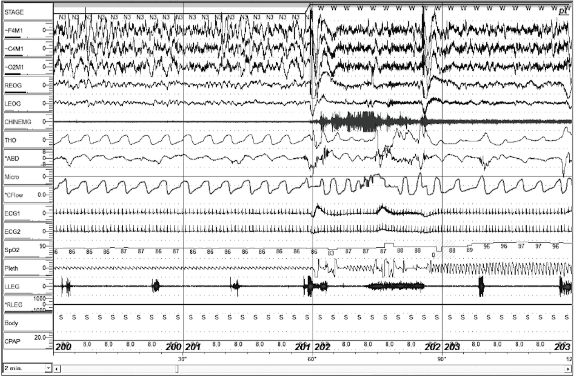 Sleep Clinics: How to Choose a Sleep Clinic and What to Expect